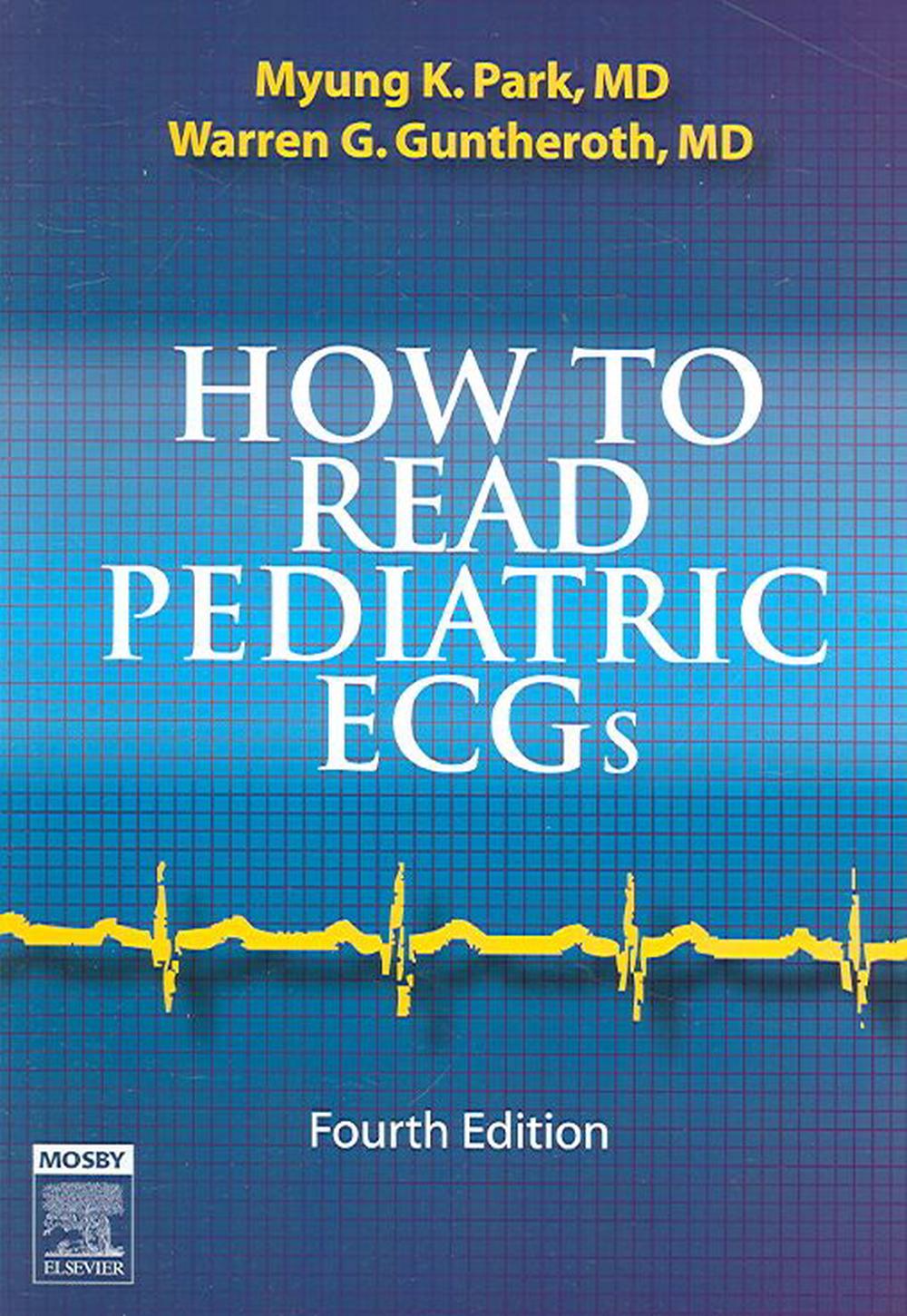 How to Read Pediatric ECGs by Warren G. Guntheroth (English) Paperback ...