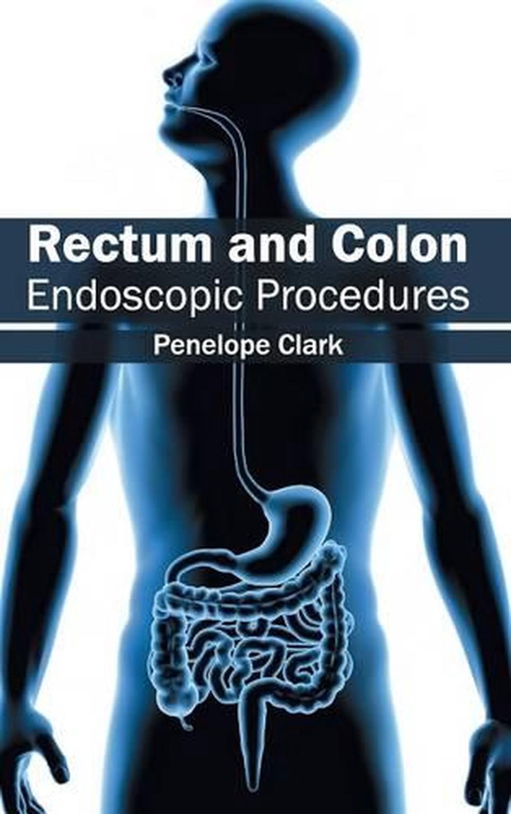 Rectum And Colon Endoscopic Procedures English Hardcover Book Free Shipping 9781632413376 Ebay